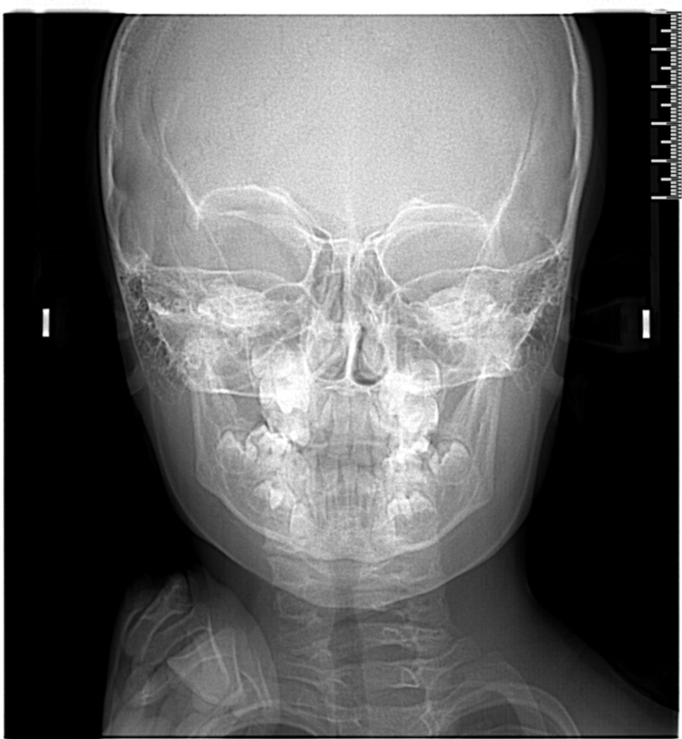 Radiologie céphalo ou téléradiographie - CISCO - Formation en ...