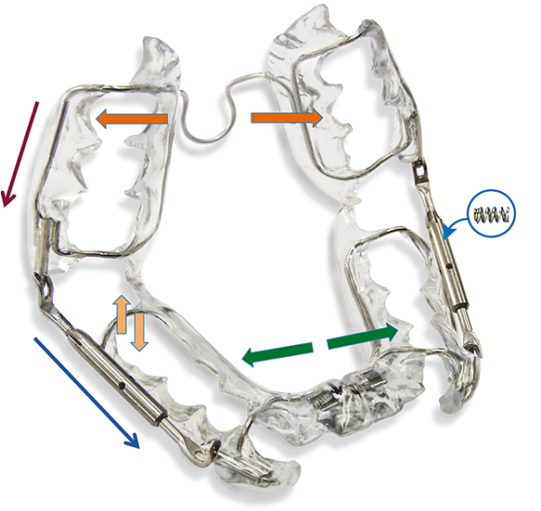 Les avantages du PUL (Propulseur universal Light) - CISCO - Formation ...