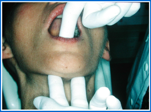 L’ATM et les dysfonctions cranio-mandibulo-cervicales partie 2 - CISCO ...