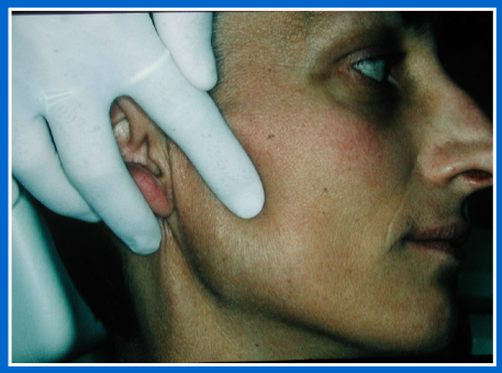 L’ATM et les dysfonctions cranio-mandibulo-cervicales partie 2 - CISCO ...