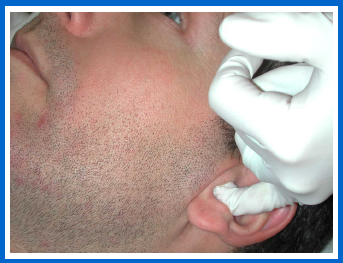 L’ATM et les dysfonctions cranio-mandibulo-cervicales partie 2 - CISCO ...